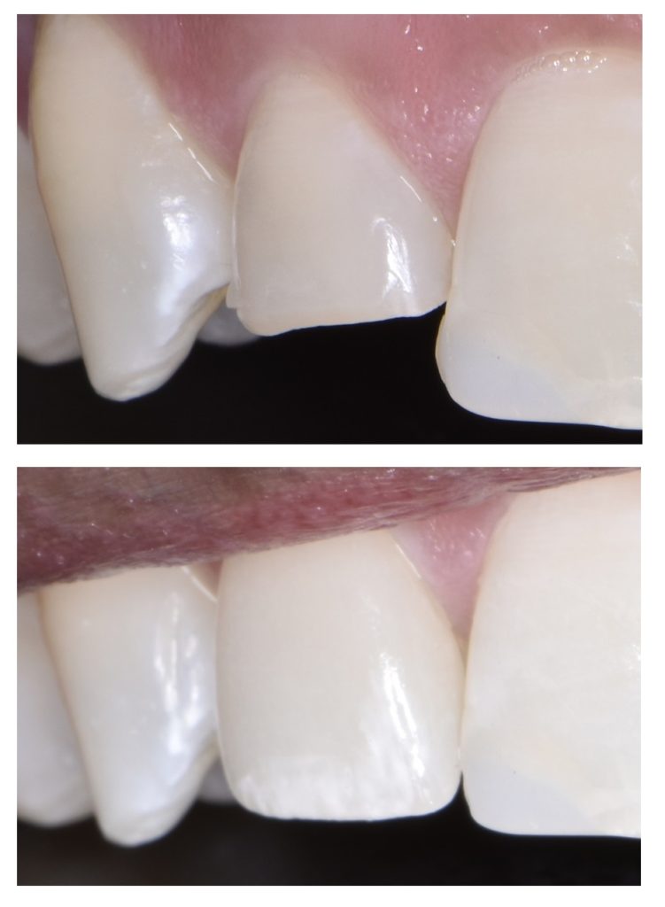 Gallery - Smile Corners