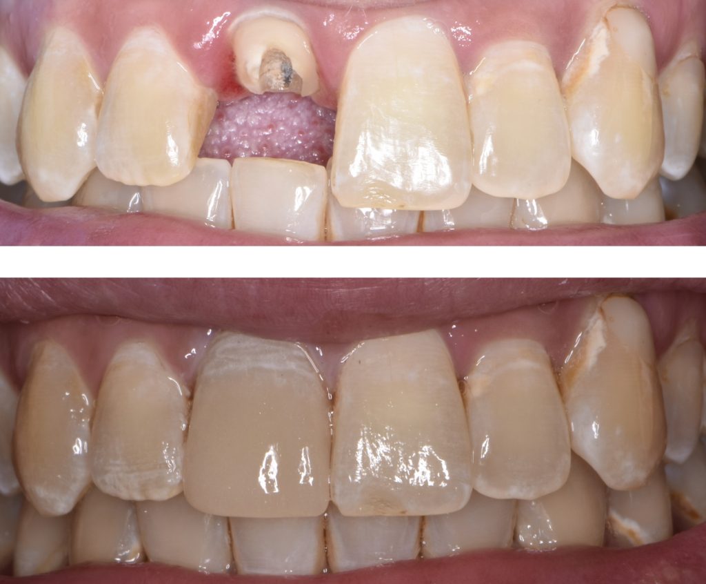 Gallery - Smile Corners