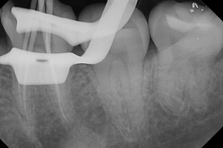 牙科X光片 - Smile Corners
