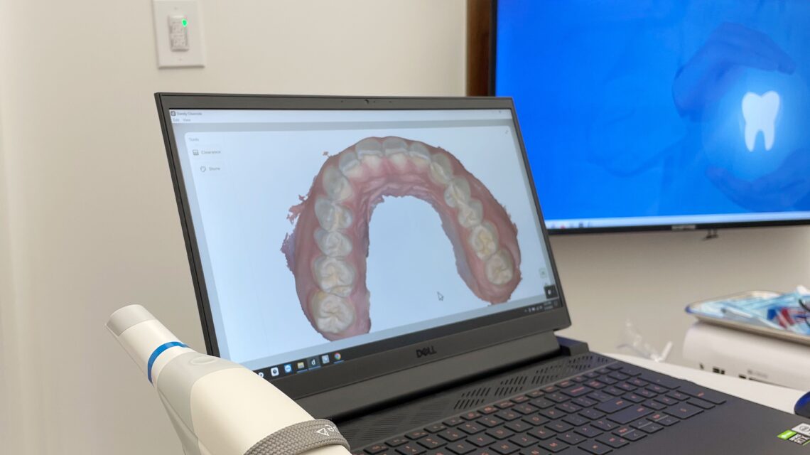 Intraoral Digital Scanner - Smile Corners